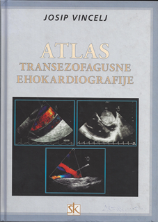 Atlas transezofagusne ehokardiografije K