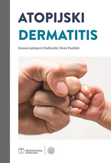 Atopijski dermatitis