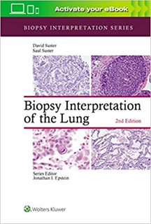 BIOPSY INTERPRETATION OF THE LUNG 2E CB