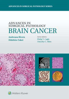 Brain Cancer Advance In Surgical Path Cb