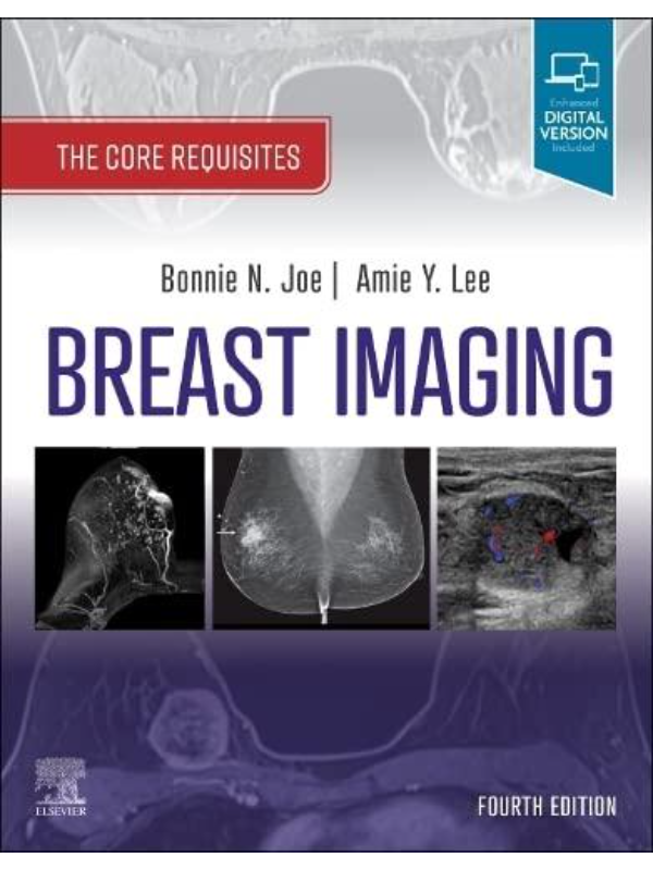 Breast Imaging, 4th Edition The Core Requisites