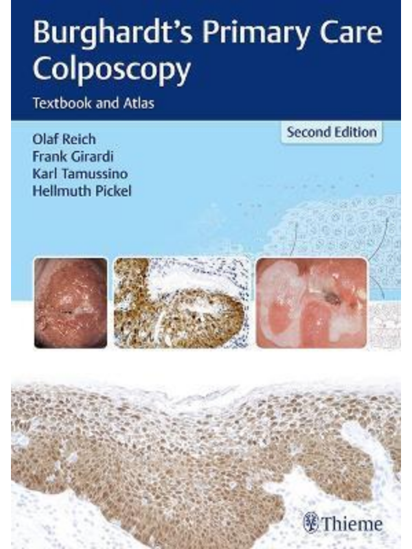 Burghardt’s Primary Care Colposcopy