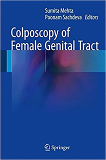 Colposcopy of Female Genital Tract