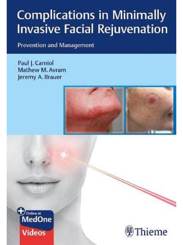 Complications in Minimally Invasive Facial RejuvenationPrevention and Management