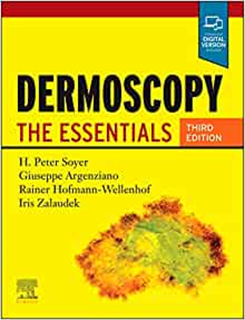 Dermoscopy