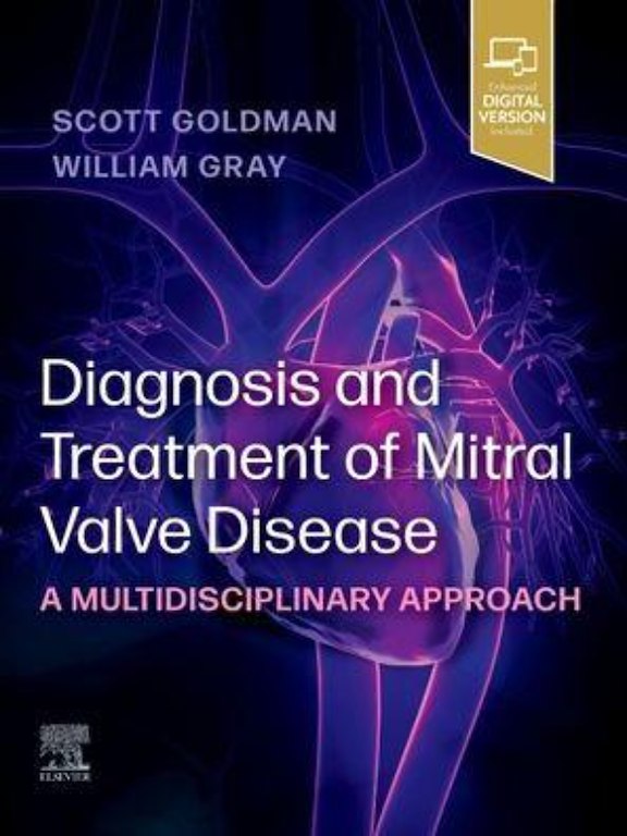Diagnosis and Treatment of Mitral Valve Disease, A Multidisciplinary Approach