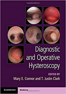 Diagnostic And Operative Hysteroscopy