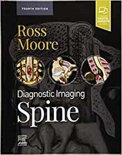 Diagnostic Imaging Spine