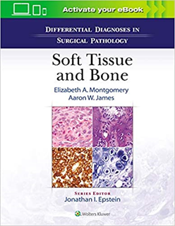 Differential Diagnoses in Surgical Pathology: Soft Tissue and Bone