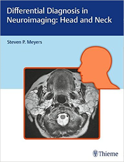 Differential Diagnosis in Neuroimaging