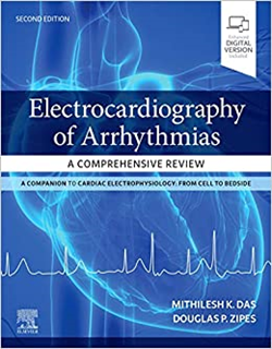 Electrocardiography of Arrhythmias: a Comprehensive Review