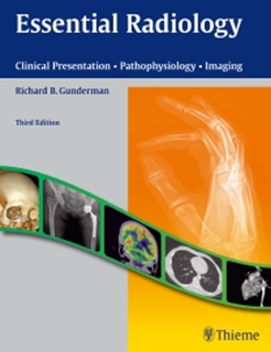 Essential Radiology: Clinical Presentation Pathophysiology Imaging