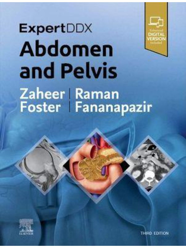 ExpertDDx: Abdomen and Pelvis, 3rd Edition