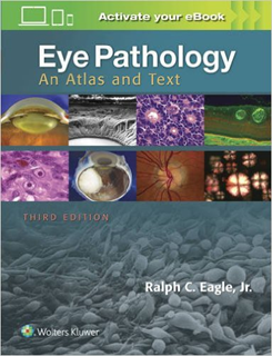 Eye Pathology: An Atlas and Text, 3 Ed