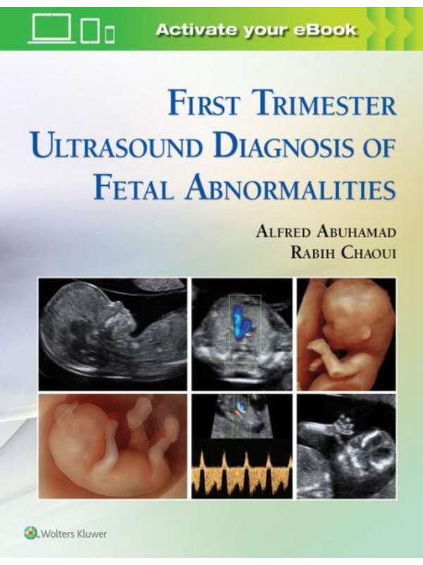 First Trimester Ultrasound Diagnosis of Fetal Abnormalities