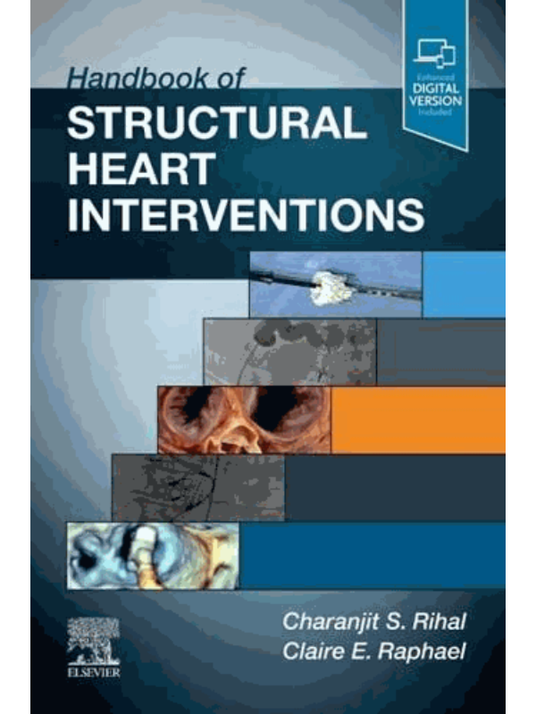 Handbook of Structural Heart Interventions