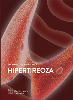 Hipertireoza