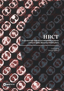 HRCT – prepoznavanje izgleda parenhimskih promena i diferencijalna dijagnoza bolesti pluća