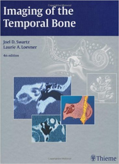 Imaging of the Temporal Bone