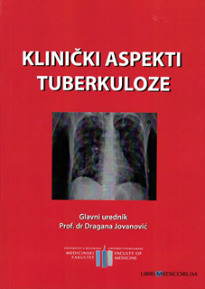 Klinički aspekti tuberkuloze