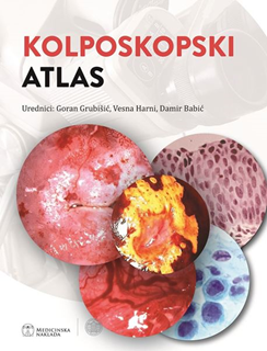 Kolposkopski atlas