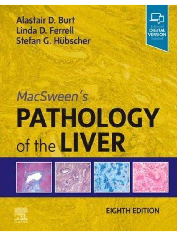 MacSween’s Pathology of the Liver, 8th Edition