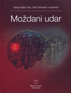 Moždani udar