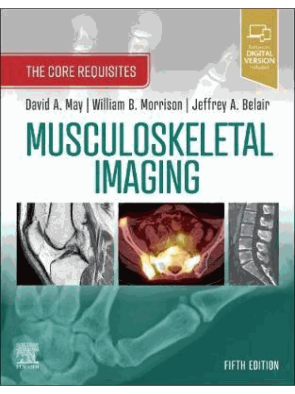 Musculoskeletal Imaging