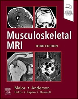 Musculoskeletal Mri