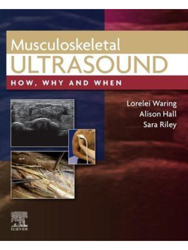 Musculoskeletal UltrasoundHow, Why and When