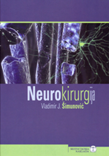 Neurokirurgija