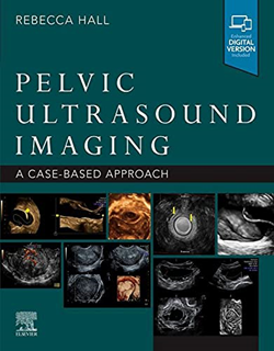 Pelvic Ultrasound ImagingA Cased-Based Approach