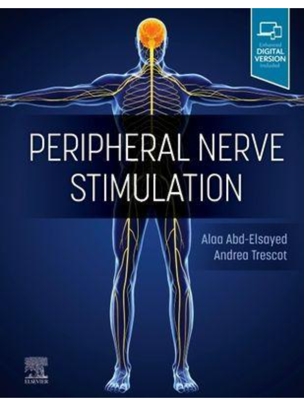 Peripheral Nerve Stimulation A Comprehensive Guide