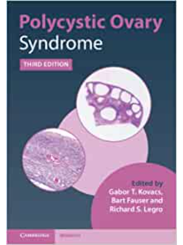 Polycystic Ovary Syndrome