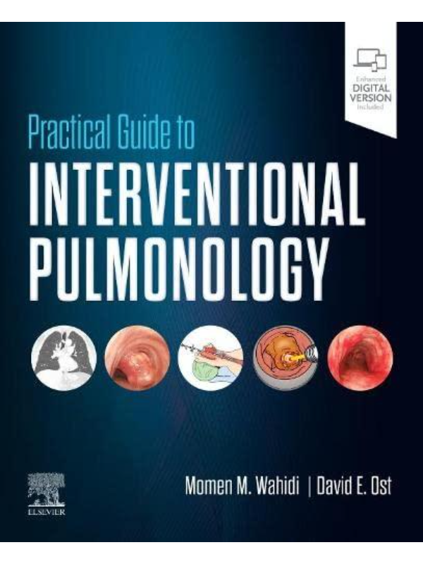 Practical Guide to Interventional Pulmonology