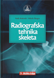 Radiografska Tehnika Skeleta