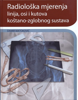 Radiološka mjerenja linija, osi i kultura koštano- zglobnog sustava