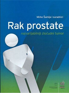 Rak prostate