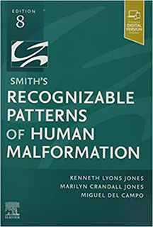 Smith’s Recognizable Patterns of Human Malformation