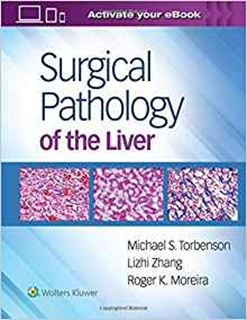Surgical Pathology Of The Liver Cb