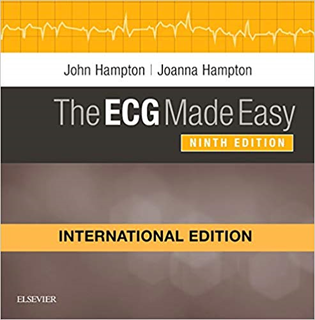 The Ecg Made Easy, International Edition