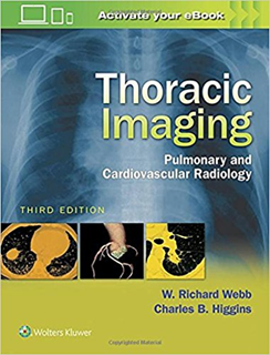 Thoracic Imaging 3E Cb