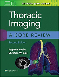 Thoracic Imaging A Core Review 2E Pb