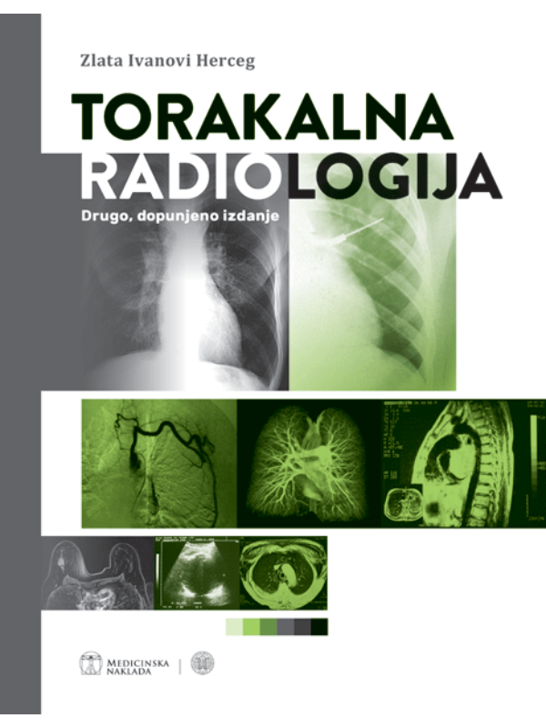 Torakalna Radiologija