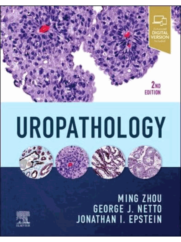 Uropathology, 2nd Edition