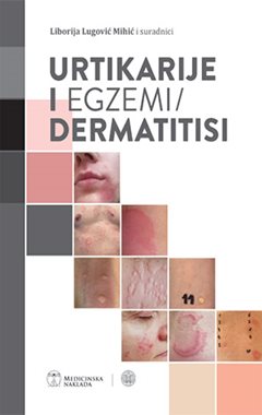 Urtikarije I Egzemi/Dermatitisi