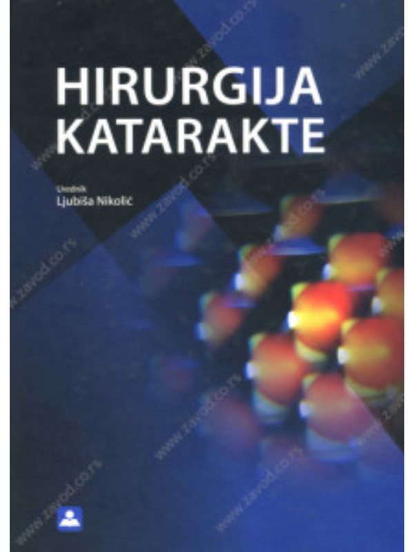 Z36129 Hirurgija katarakte