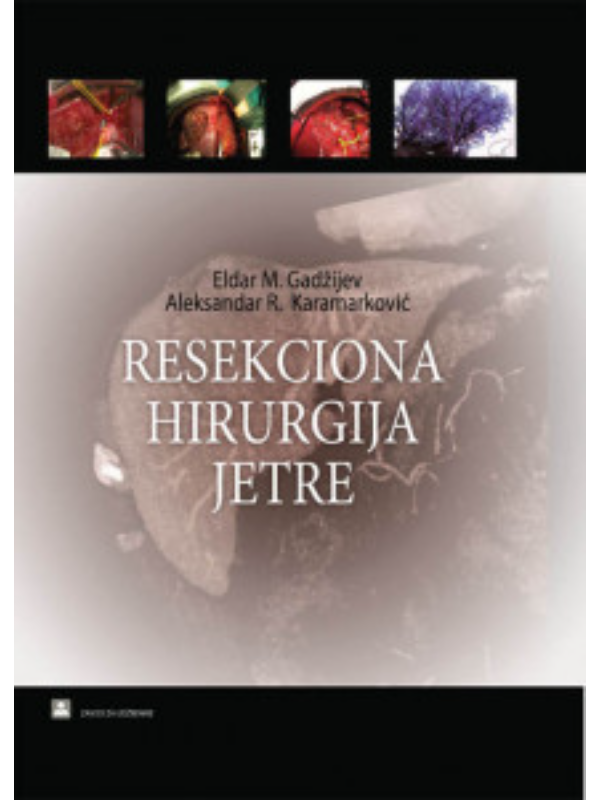 Resekciona hirurgija jetre 36146