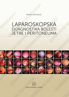 Z36165 Laparoskopska dijagnostika bolesti jetre i peritoneuma