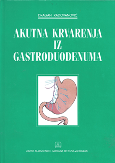 Z36382 Akutna krvarenja iz gastroduodenuma